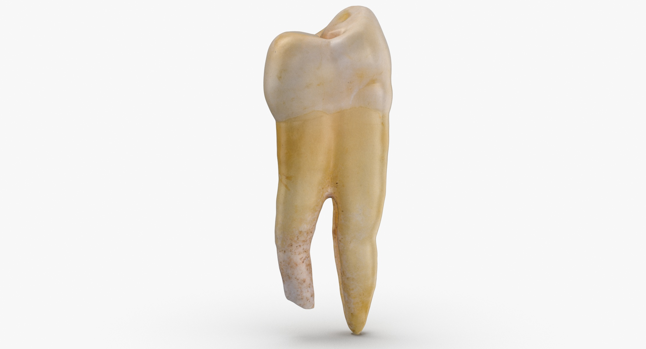 3D model Human Teeth Collection 01 - 43 models - TurboSquid 1753765