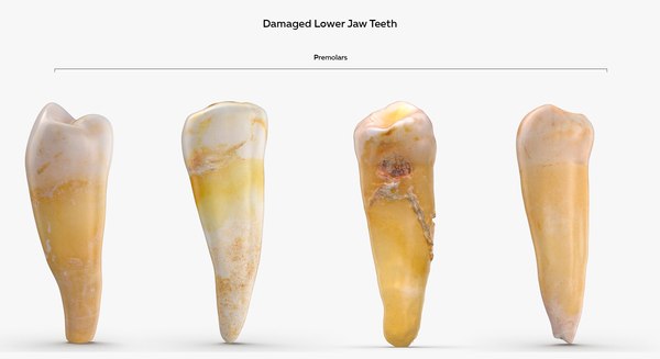 3D model Human Teeth Collection 01 - 43 models - TurboSquid 1753765
