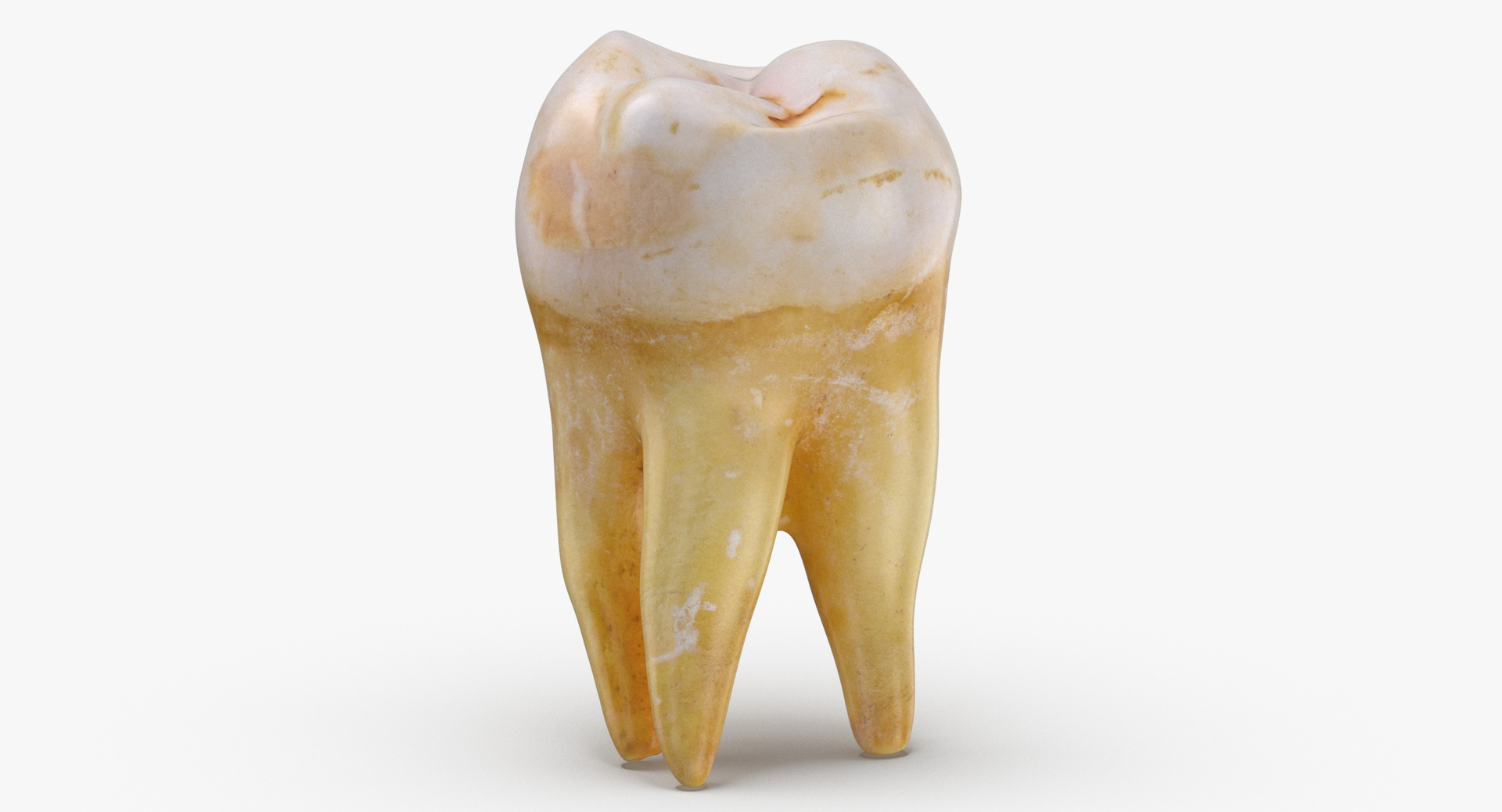 3D model Human Teeth Collection 01 - 43 models - TurboSquid 1753765