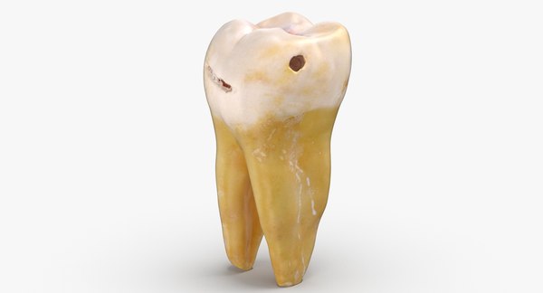 3D model Human Teeth Collection 01 - 43 models - TurboSquid 1753765