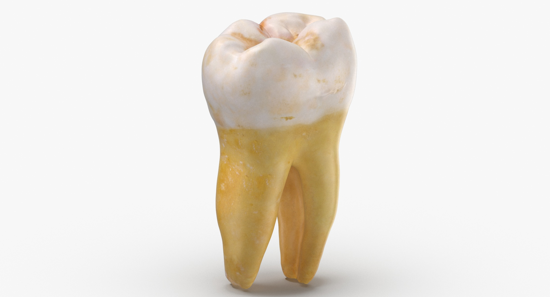 3D model Human Teeth Collection 01 - 43 models - TurboSquid 1753765