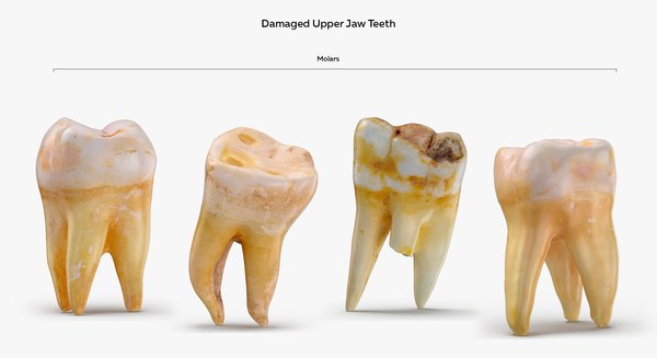 3D model Human Teeth Collection 01 - 43 models - TurboSquid 1753765