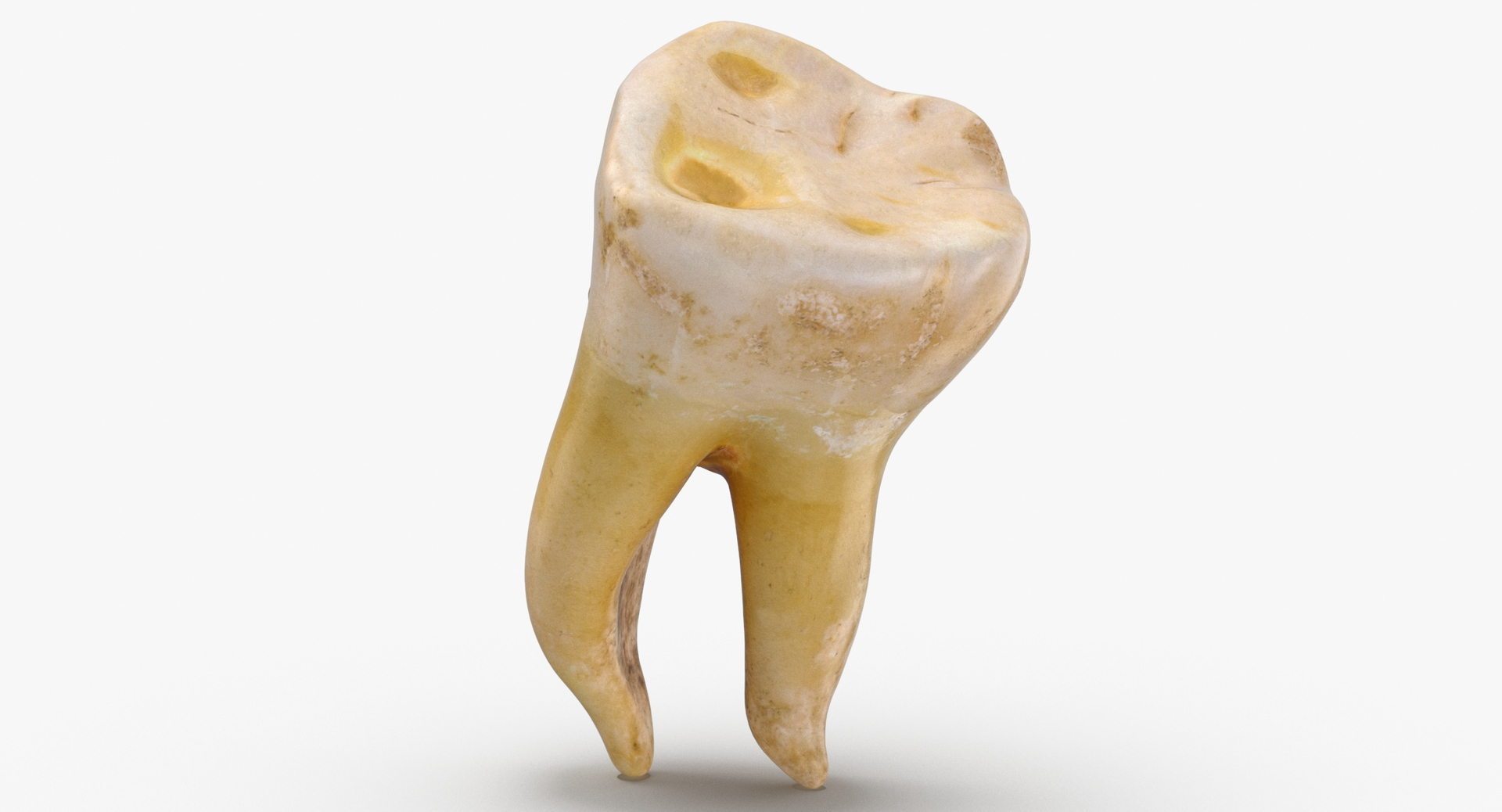3D model Human Teeth Collection 01 - 43 models - TurboSquid 1753765