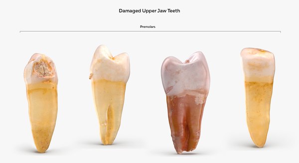 3D model Human Teeth Collection 01 - 43 models - TurboSquid 1753765