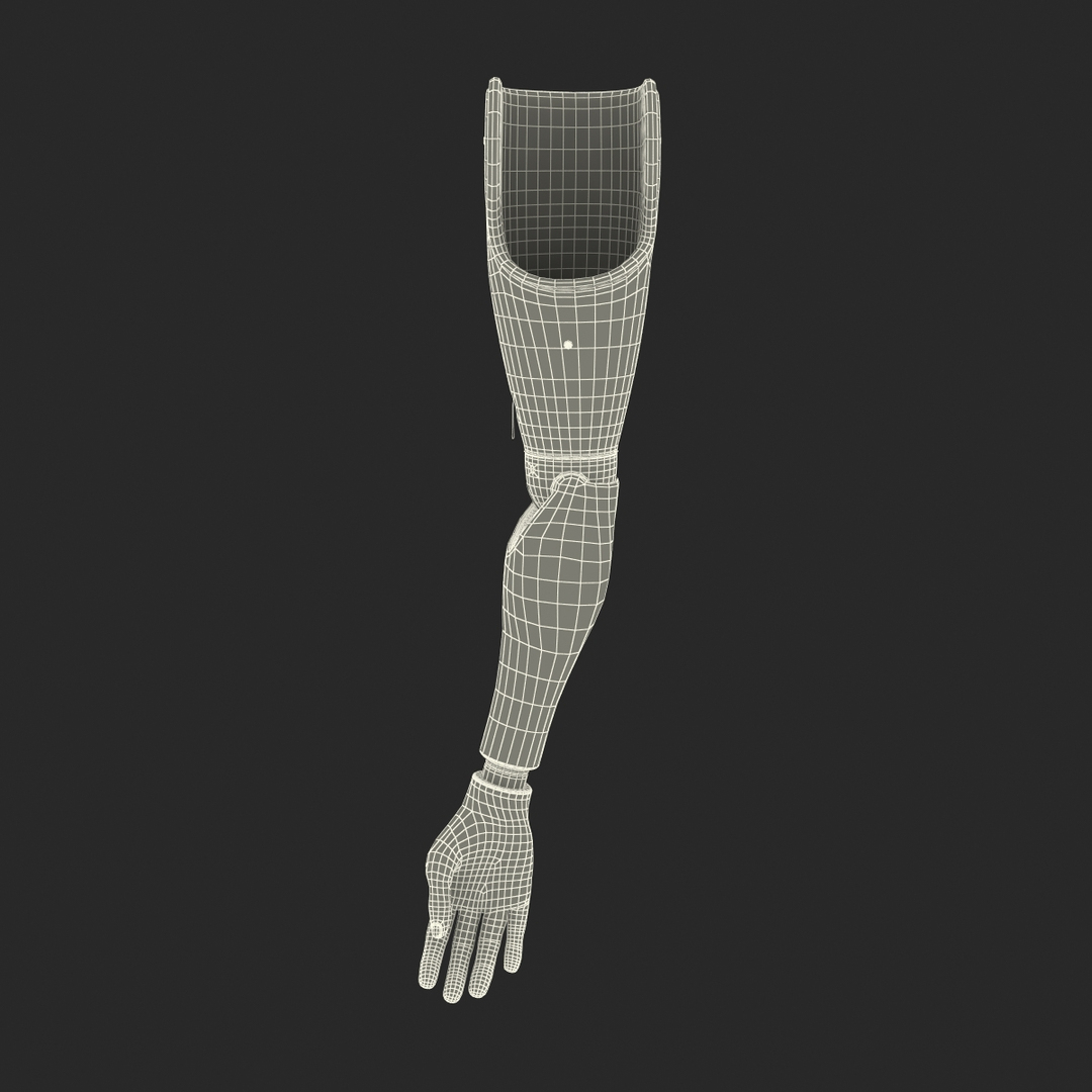 3d Prosthetic Arm Model