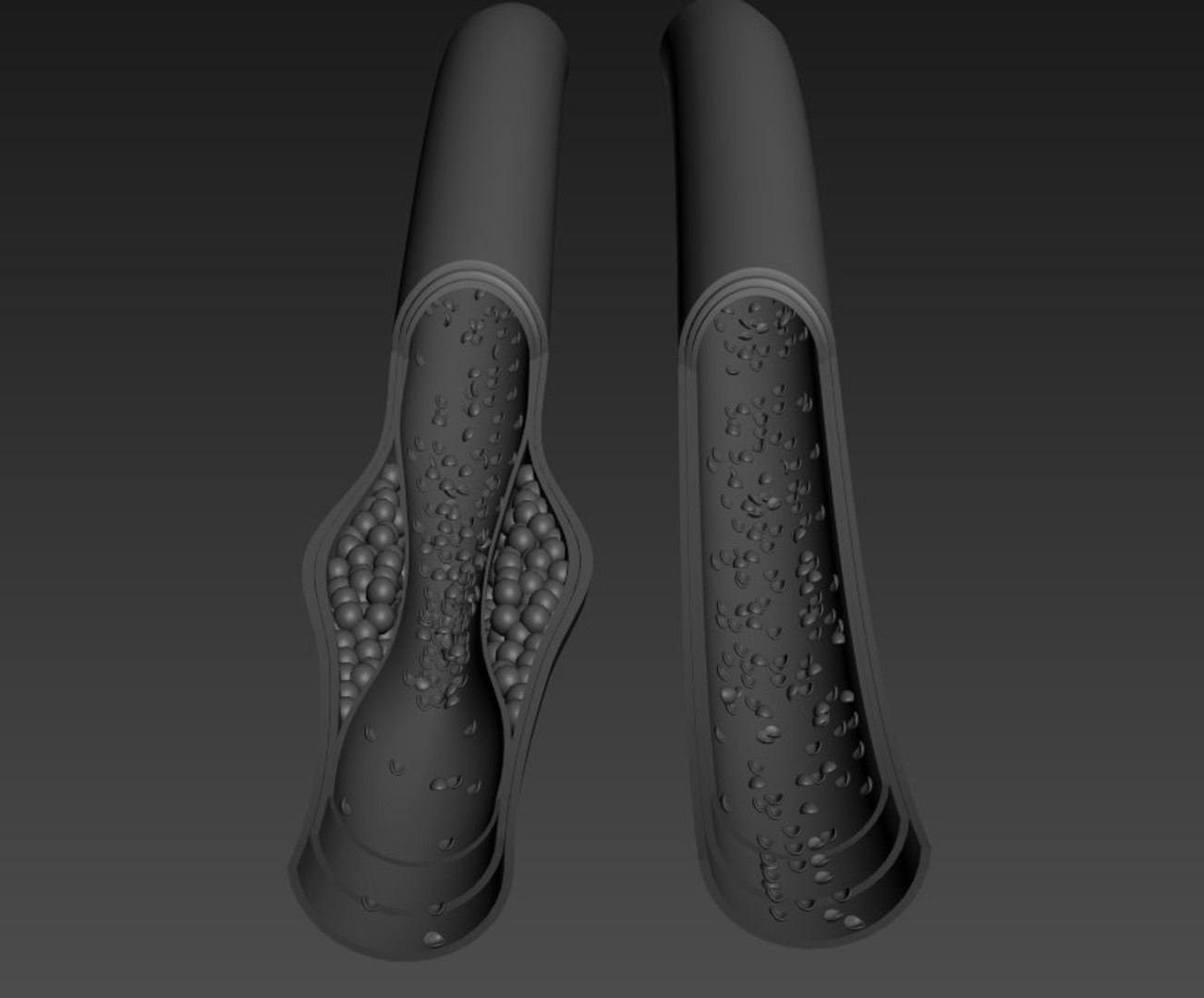 3D Model Blood Vessel Normal Damages - TurboSquid 1243108