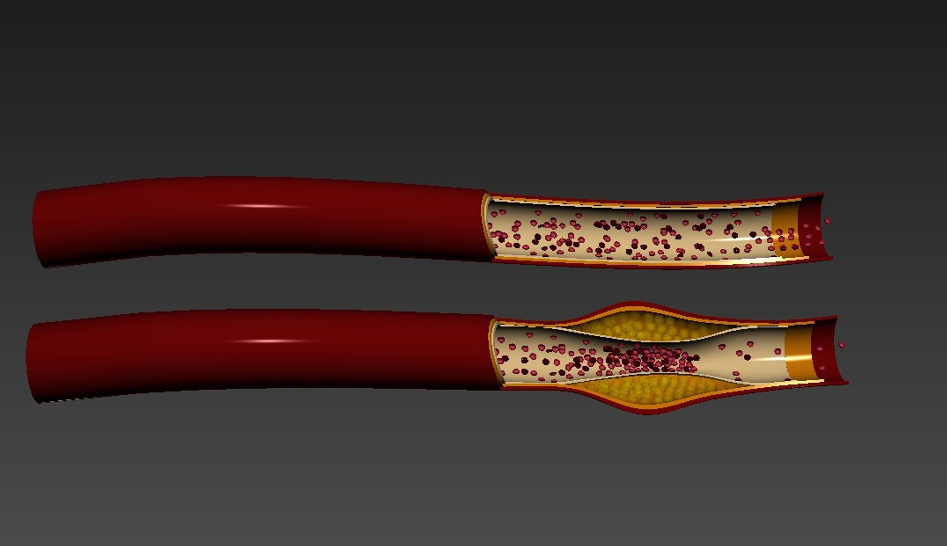 3D Model Blood Vessel Normal Damages - TurboSquid 1243108