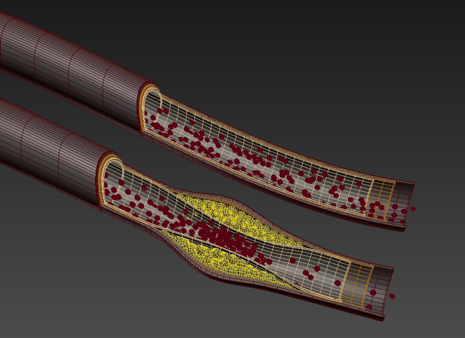 3D Model Blood Vessel Normal Damages - TurboSquid 1243108