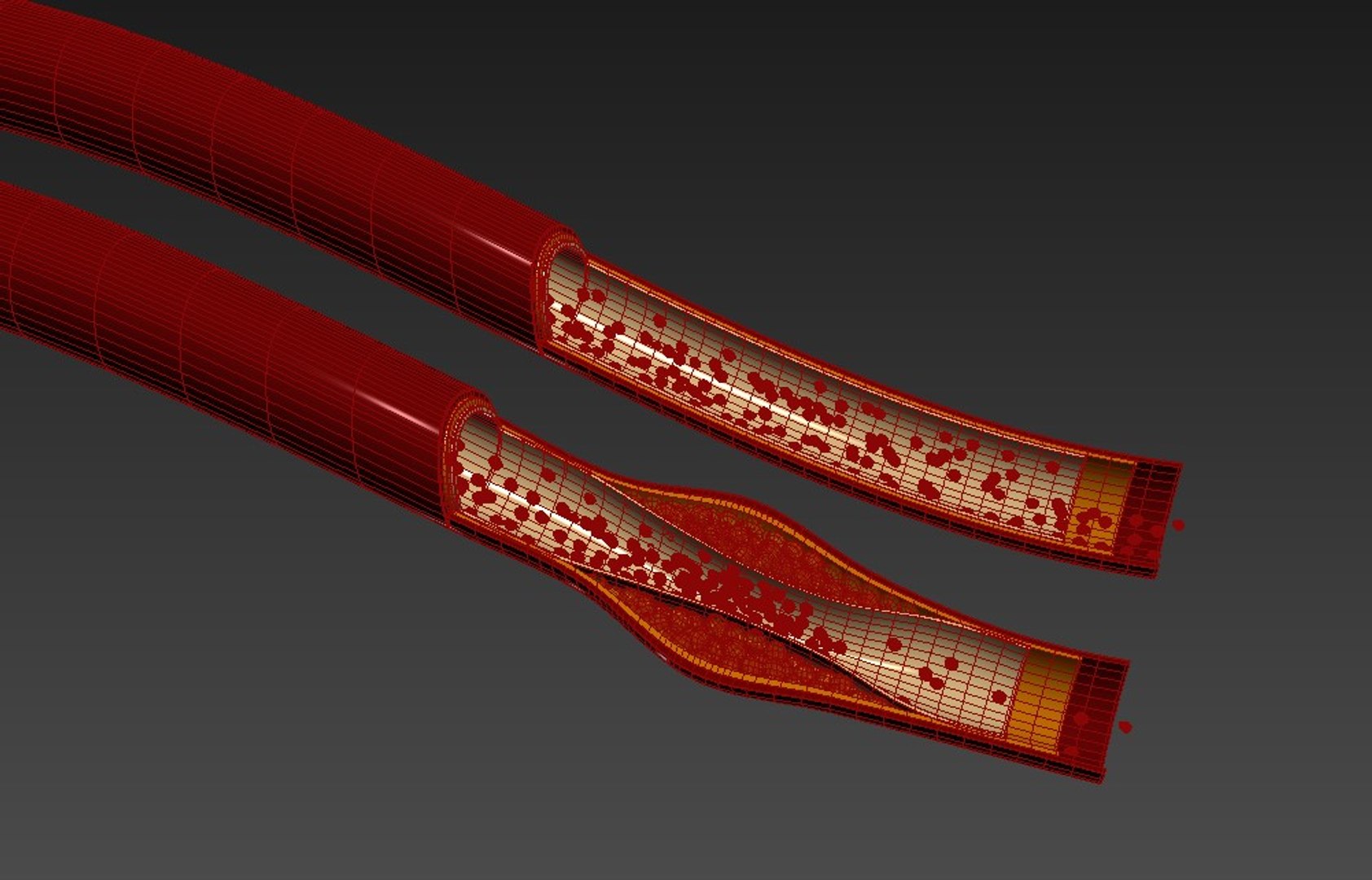 3D Model Blood Vessel Normal Damages - TurboSquid 1243108