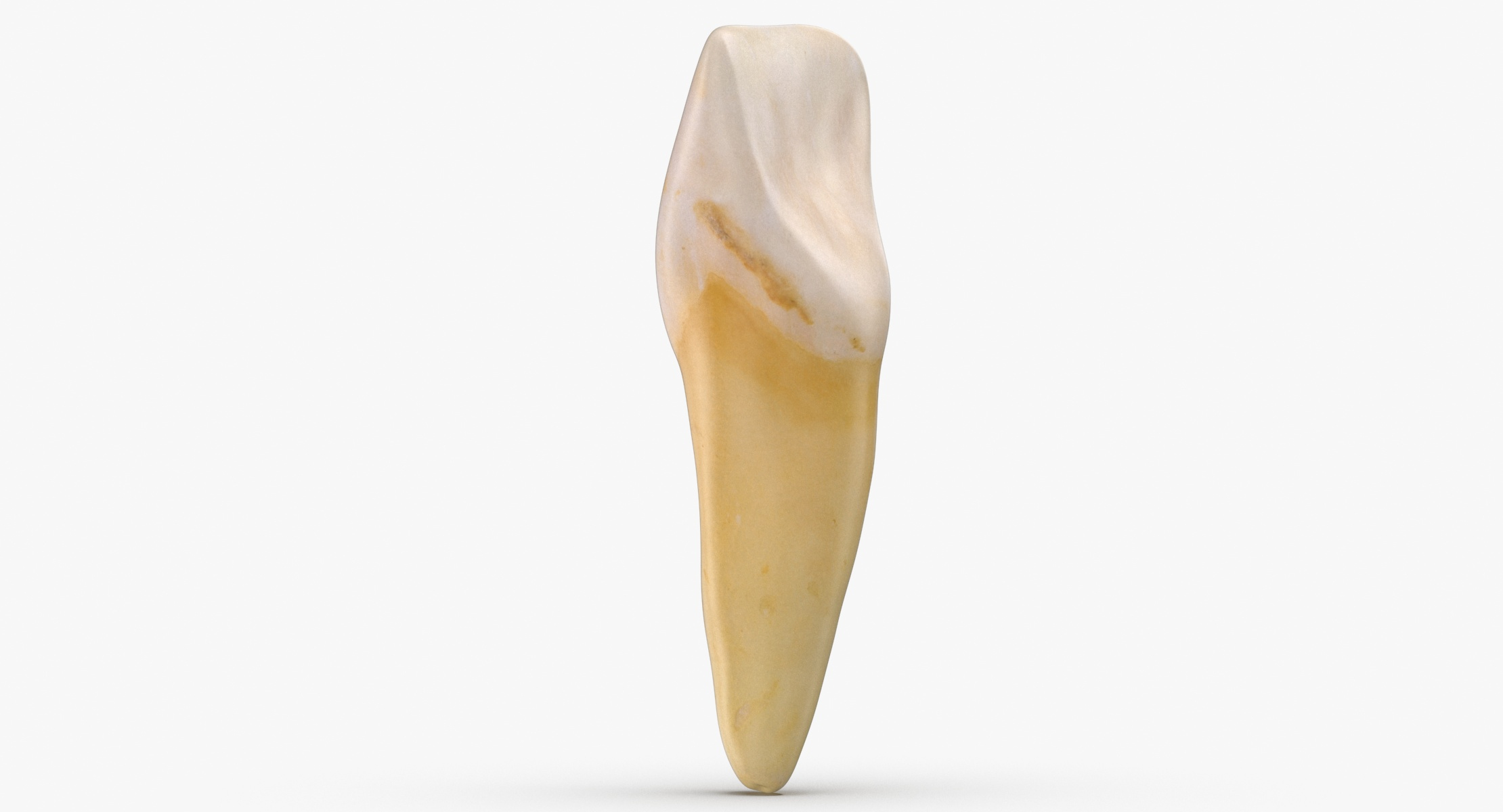 Human Upper Jaw Incisors Clean and Broken Collection - 6 models 3D ...