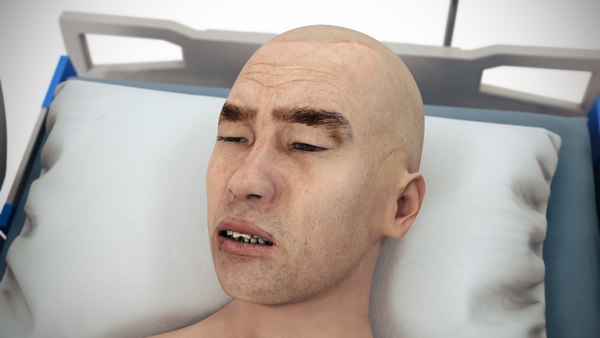 3D model patient medical bed - TurboSquid 1647454