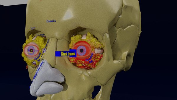 modelo 3d ojo reventado - TurboSquid 1773924