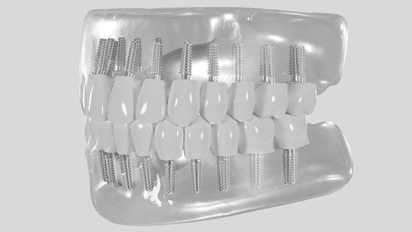 alien augmentation implant 3d max