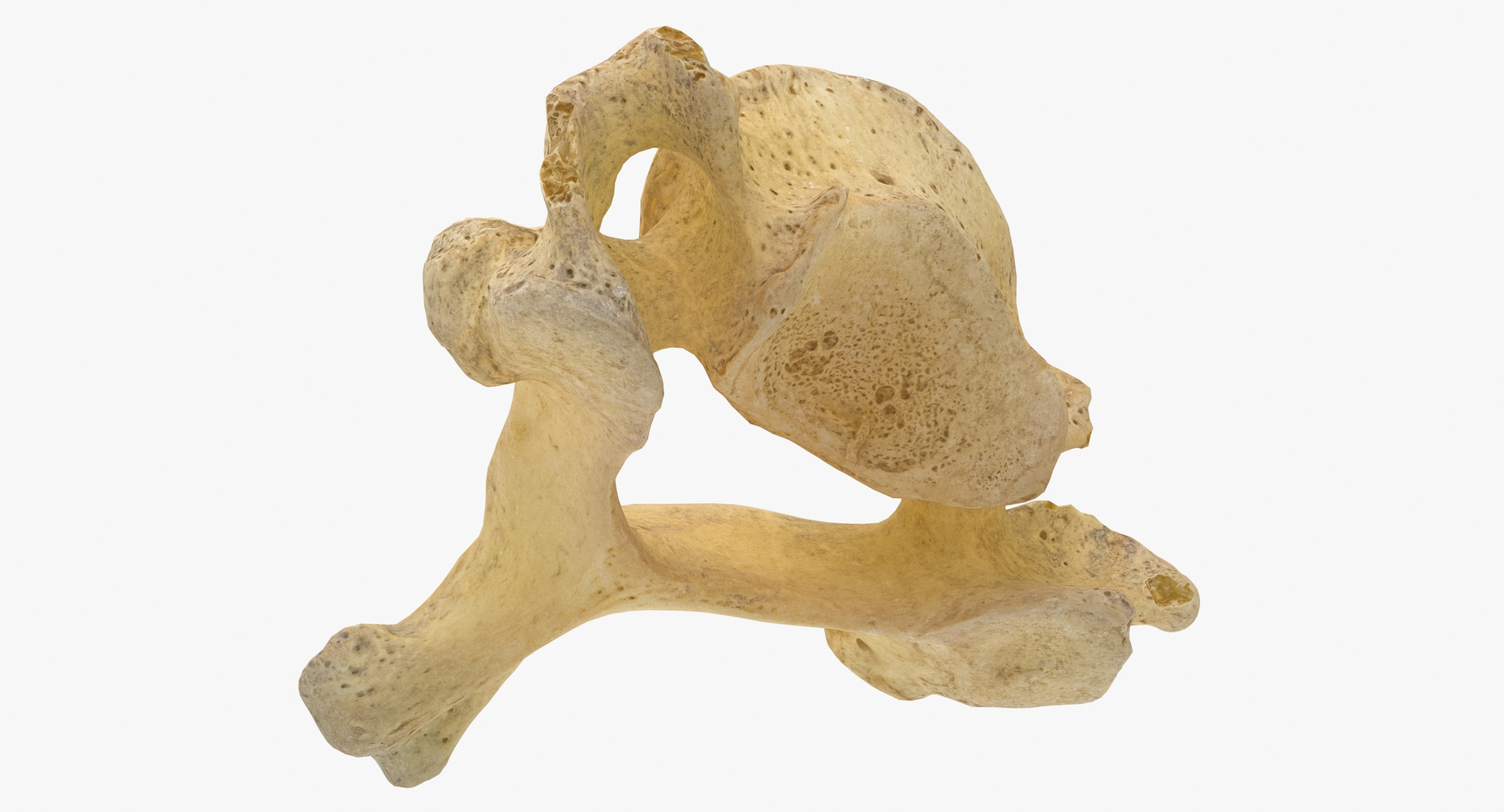 modelo 3d Vértebras cervicales reales C7 rota - TurboSquid 1709339