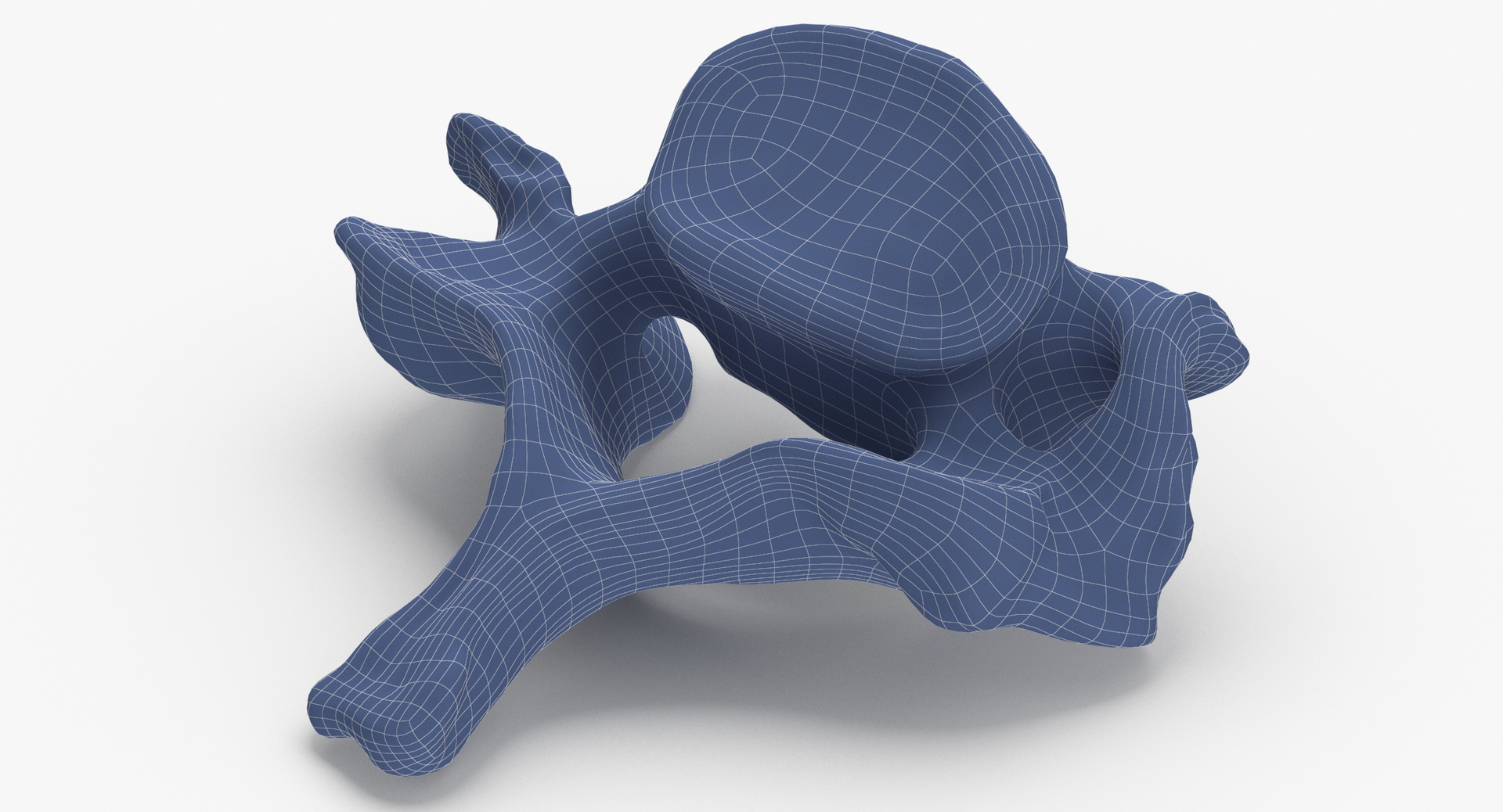 modelo 3d Vértebras cervicales reales C7 rota - TurboSquid 1709339