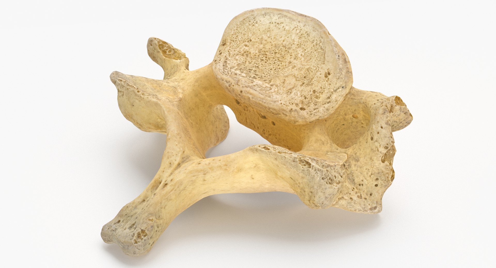 3D Cervical Vertebrae C7 Real Model - TurboSquid 1709339