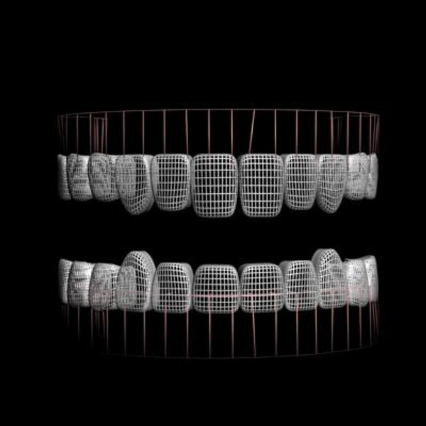 free teeth 3d model