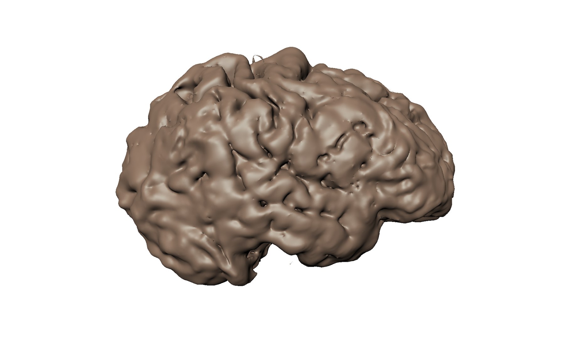 Ct Scan Human Brain 3D Model - TurboSquid 1381342