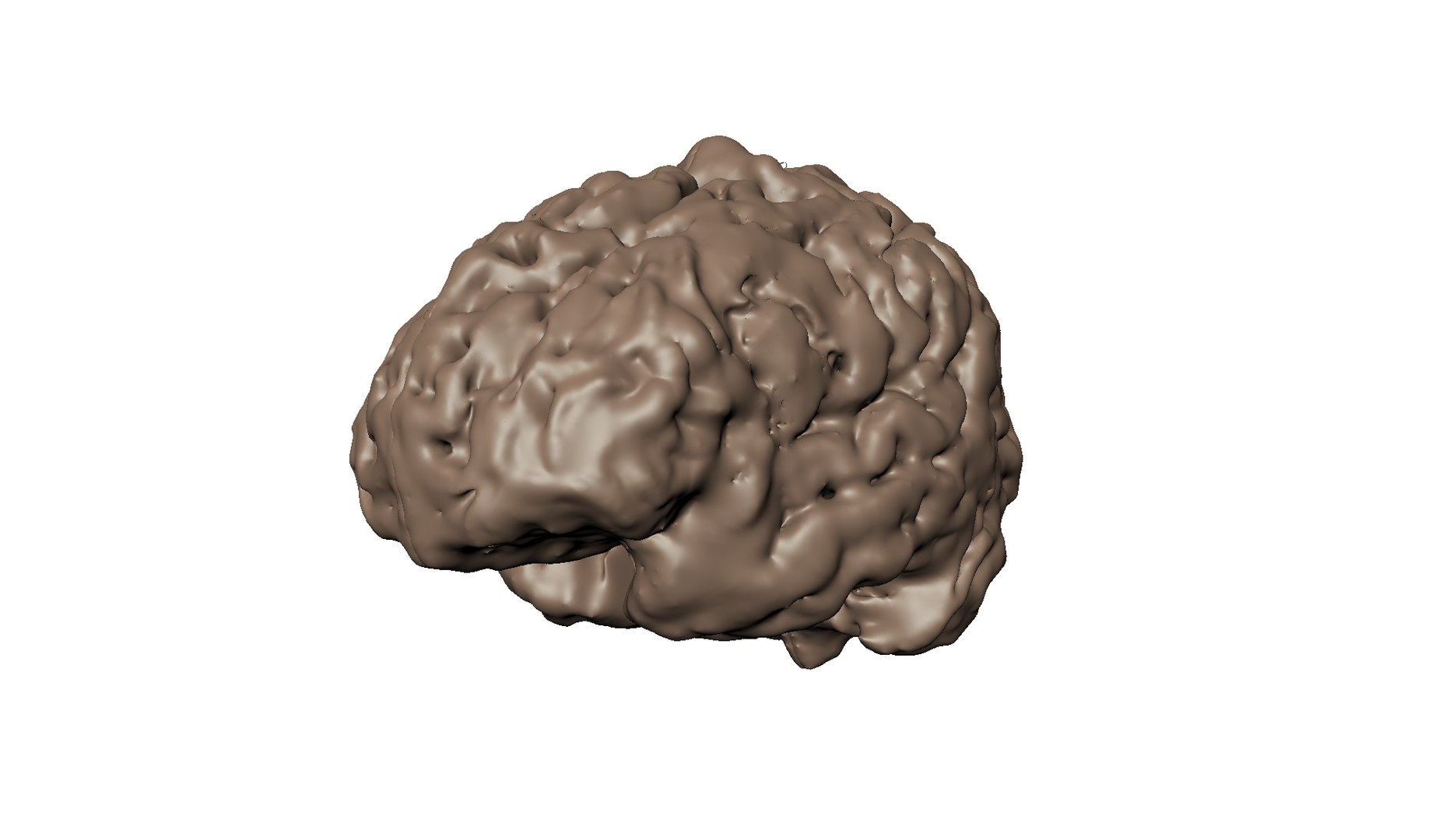 Ct Scan Human Brain 3D Model - TurboSquid 1381342