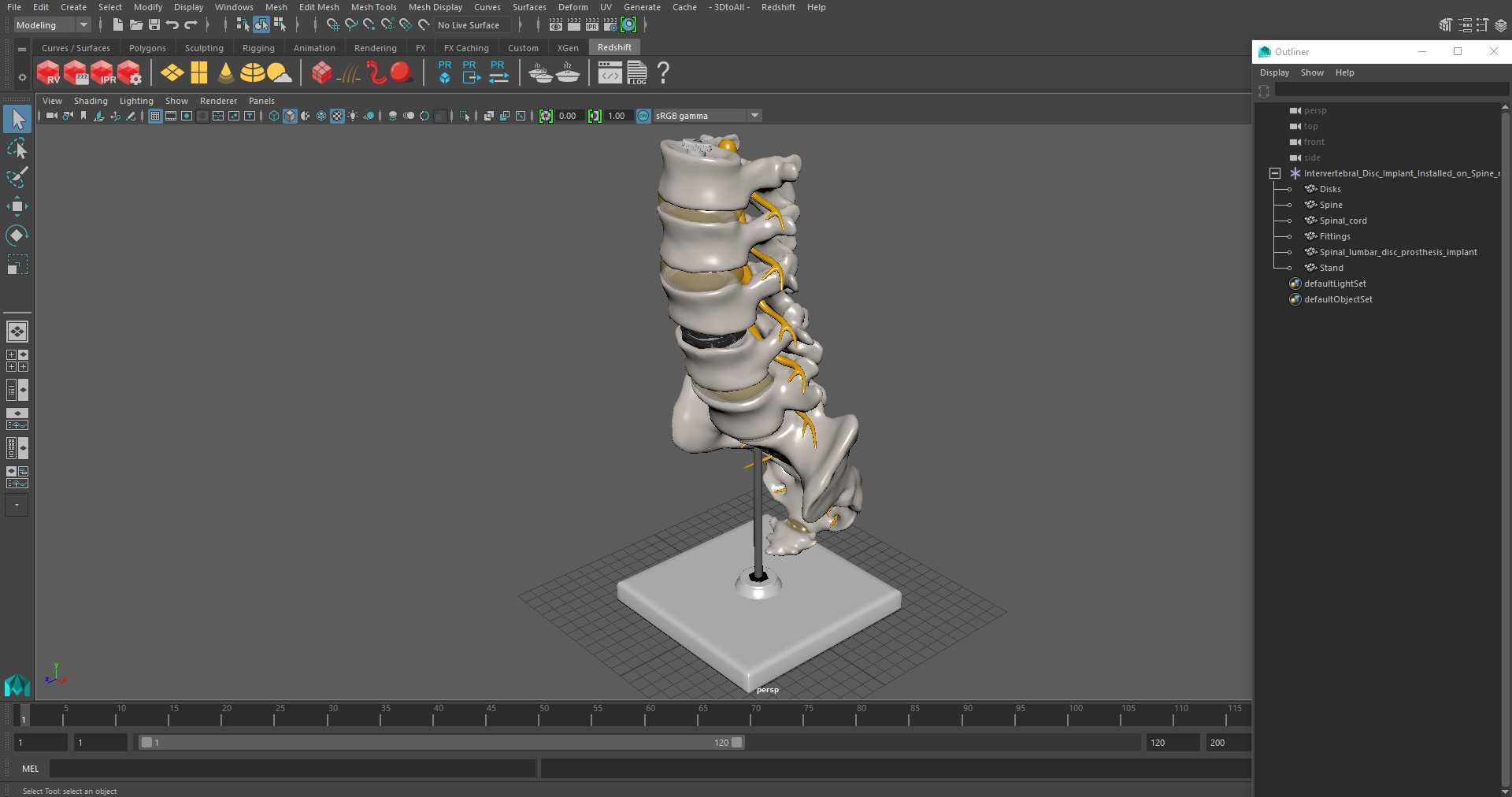 3D Intervertebral Disc Implant Installed On Spine - TurboSquid 2205533