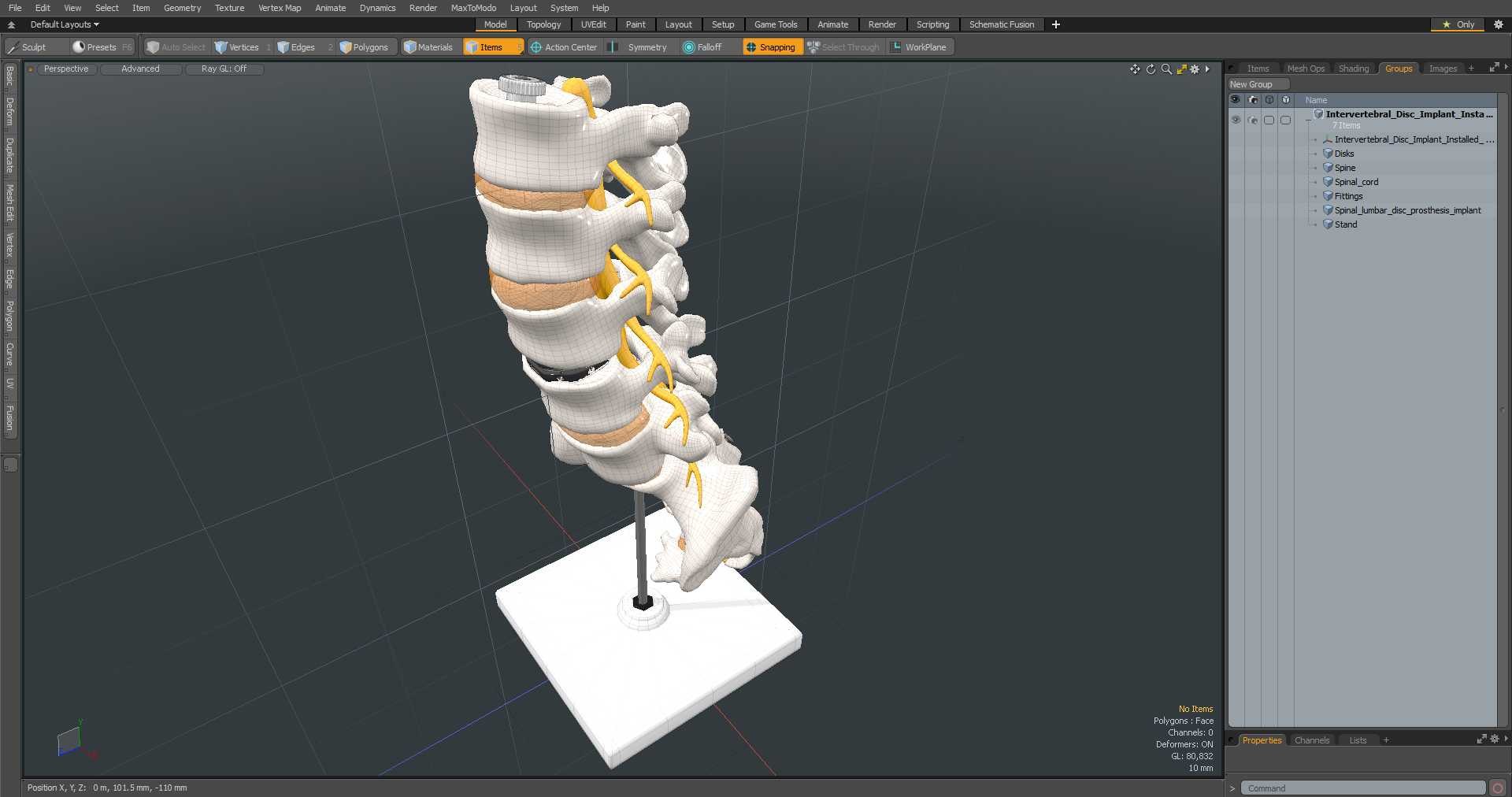 3D Intervertebral Disc Implant Installed On Spine - TurboSquid 2205533