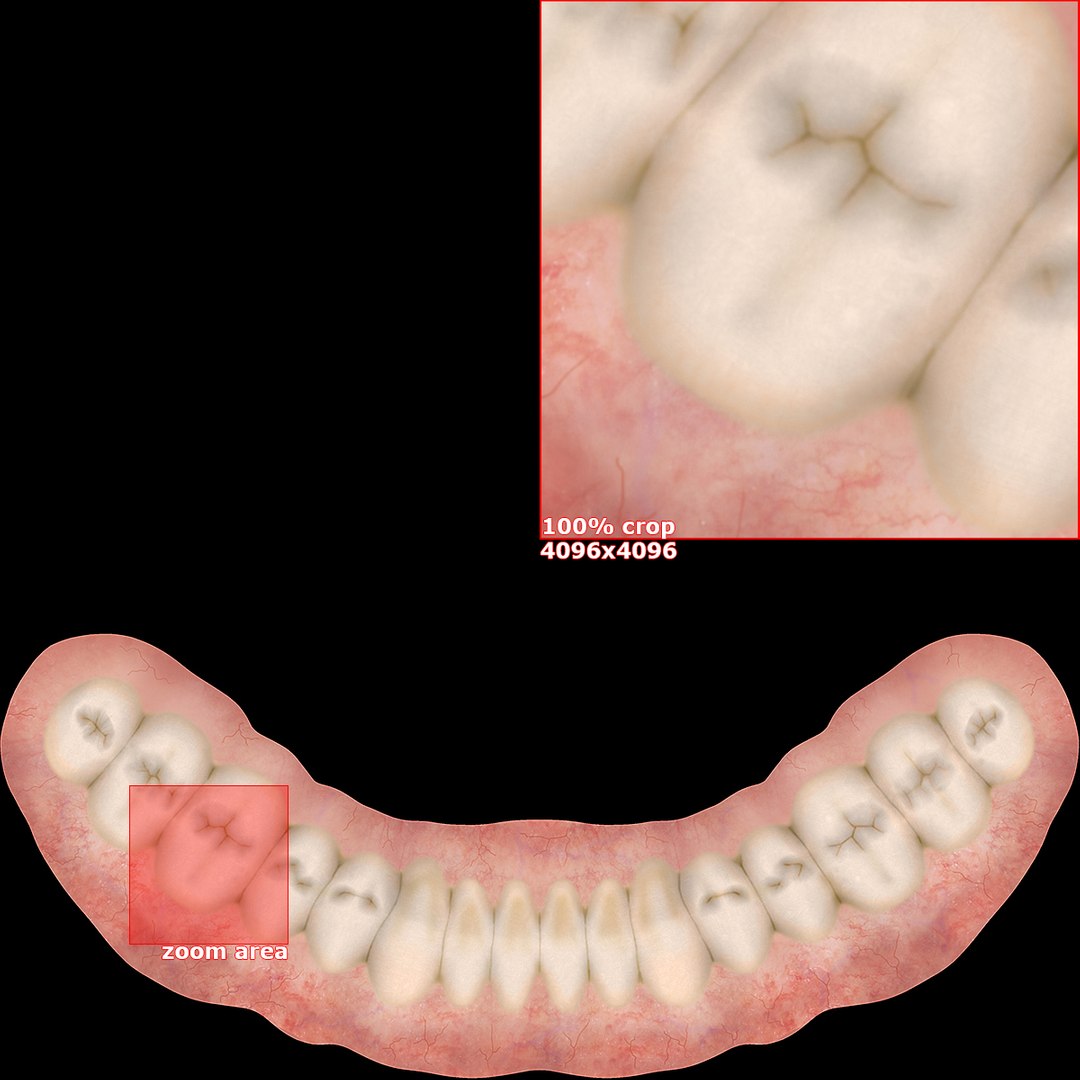Realistic Orthodontics 3d Max
