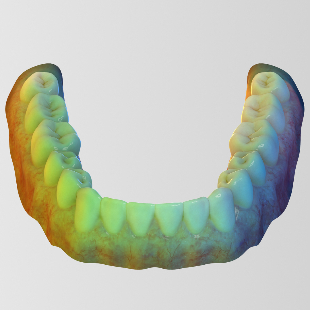 Realistic Orthodontics 3d Max