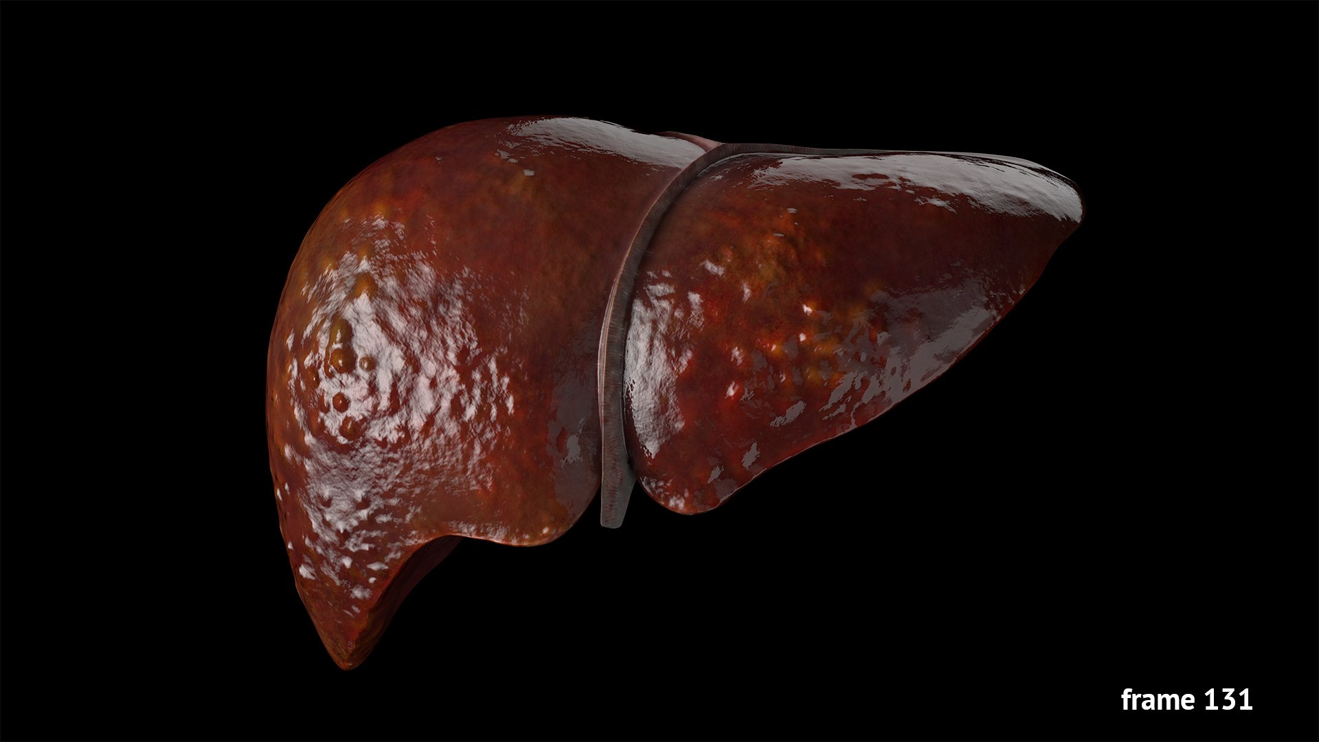 3D Model Liver Damaging Stages Animation - TurboSquid 1737157
