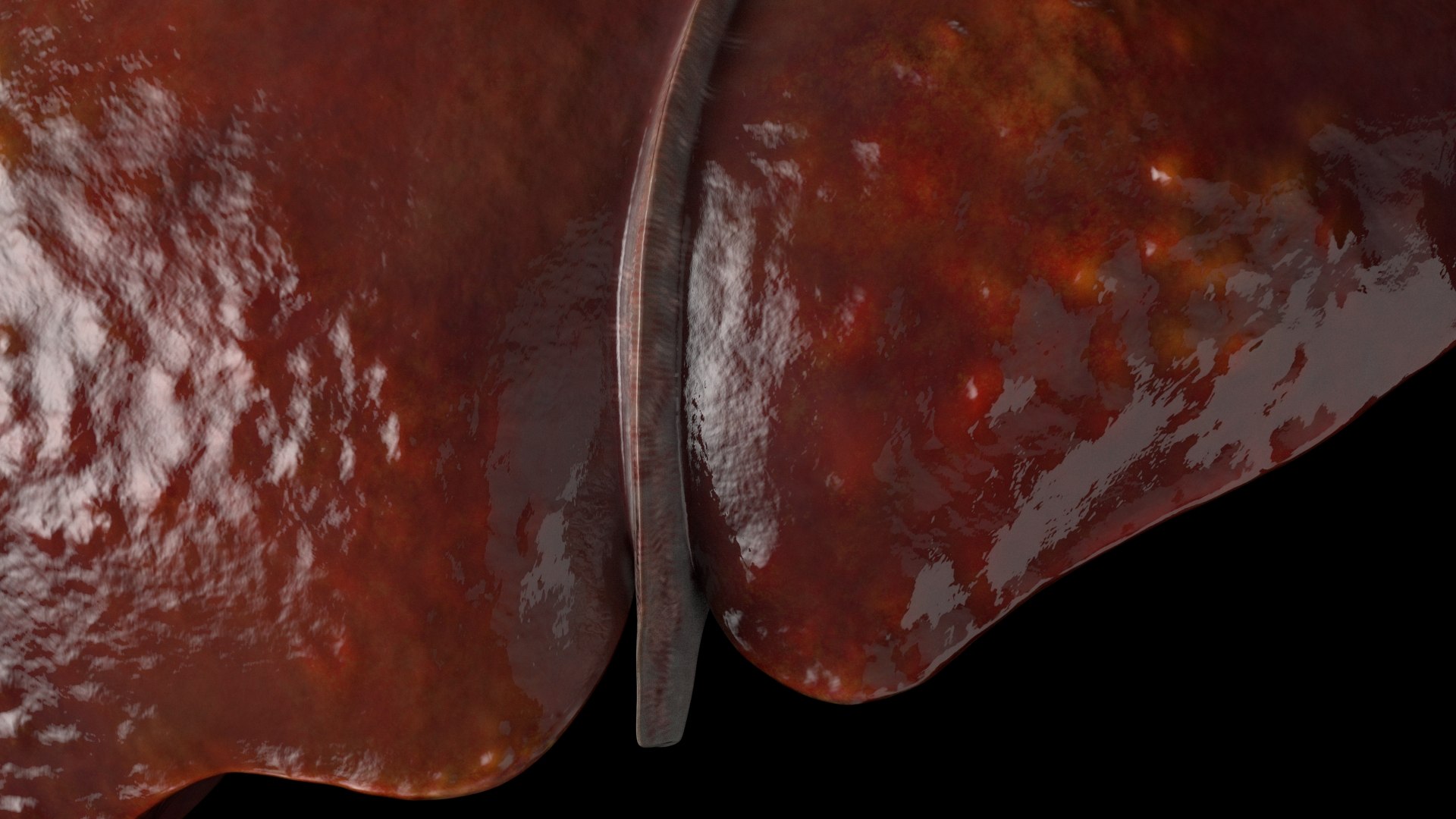3D Model Liver Damaging Stages Animation - TurboSquid 1737157