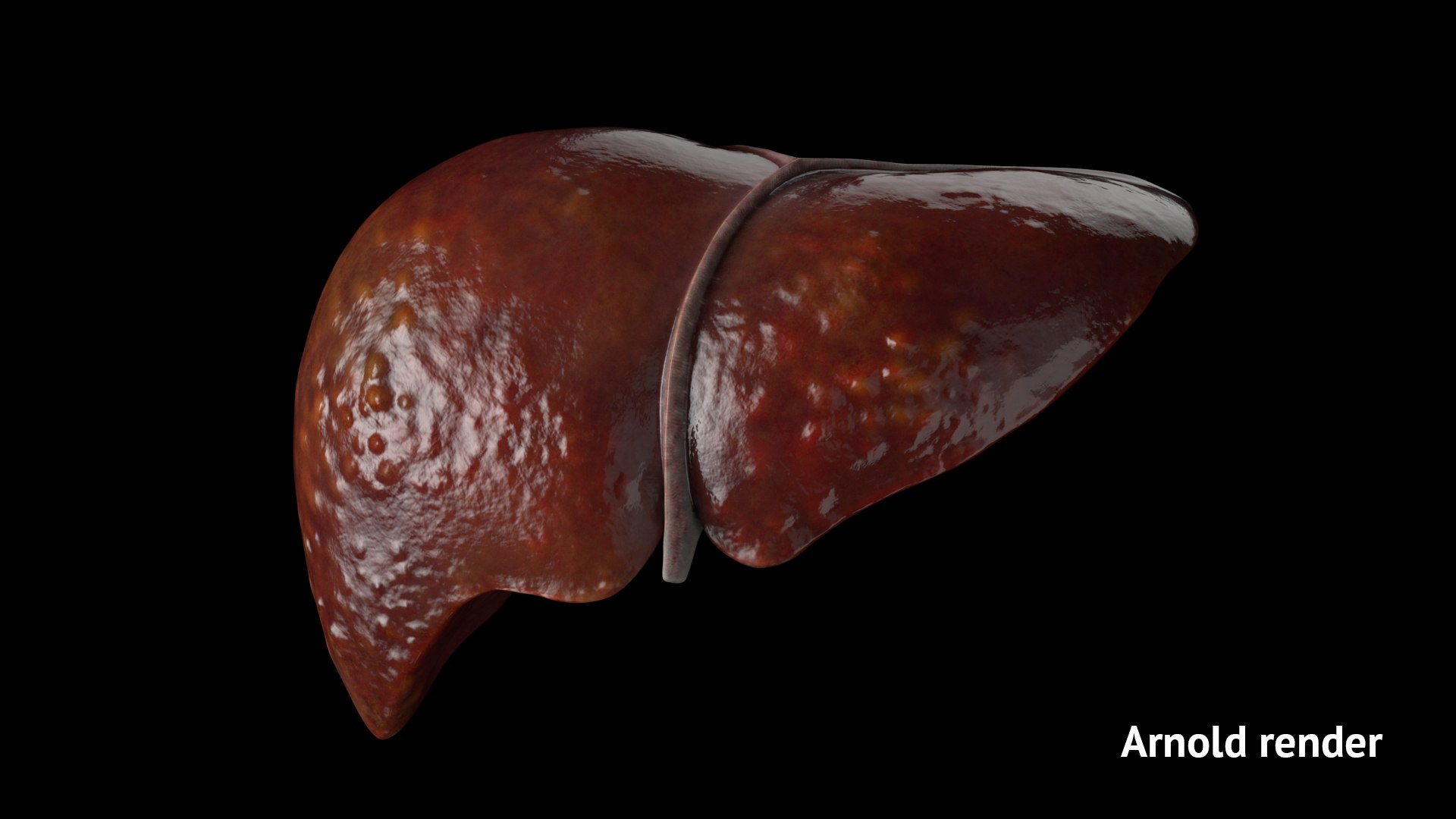 3D model Liver damaging stages animation - TurboSquid 1737157