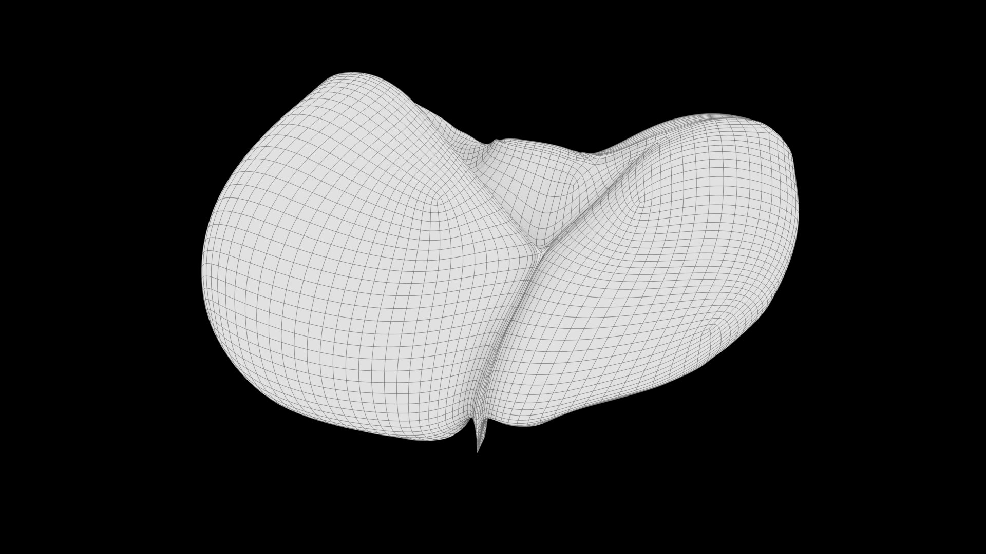 3D model Liver damaging stages animation - TurboSquid 1737157