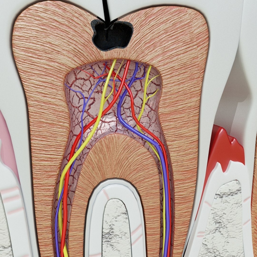 Teeth Pathologies - Tooth 3d 3ds