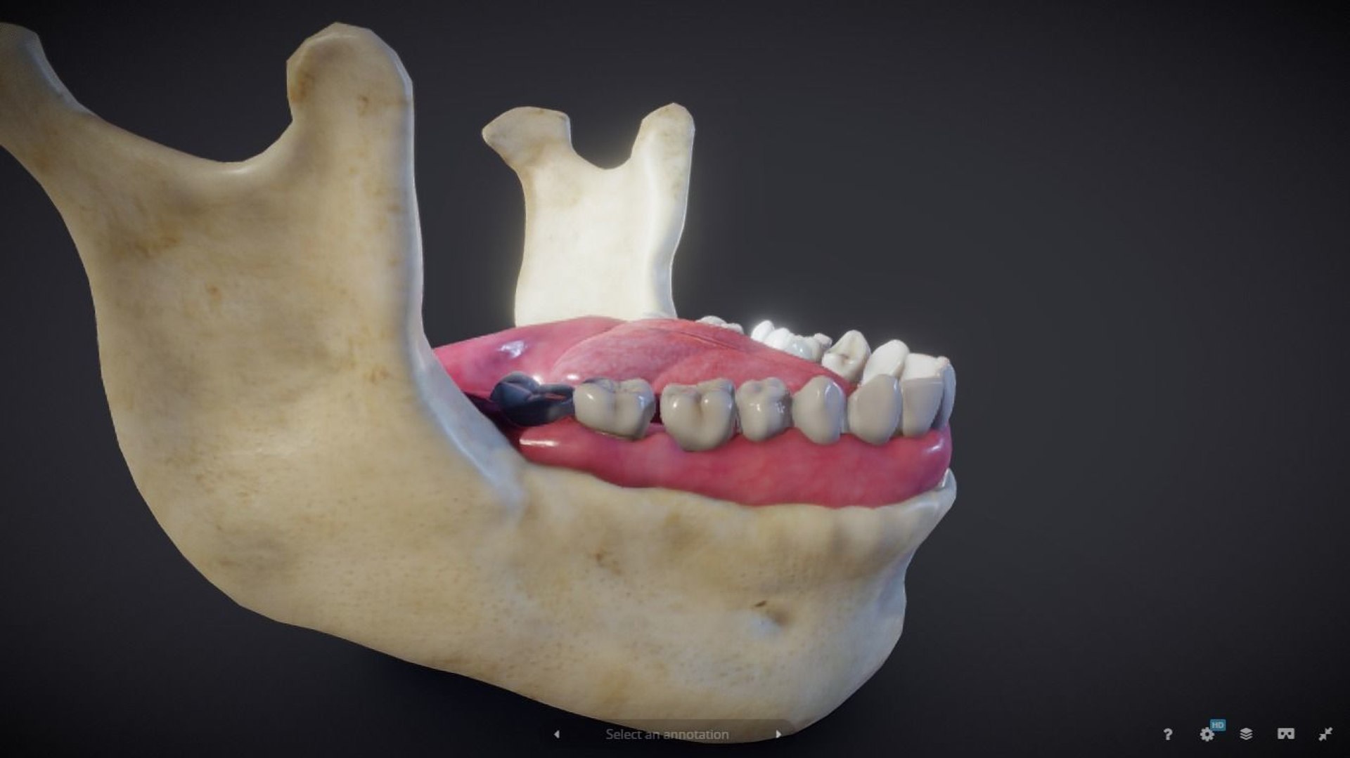 Tooth Mandible Model - TurboSquid 1618843