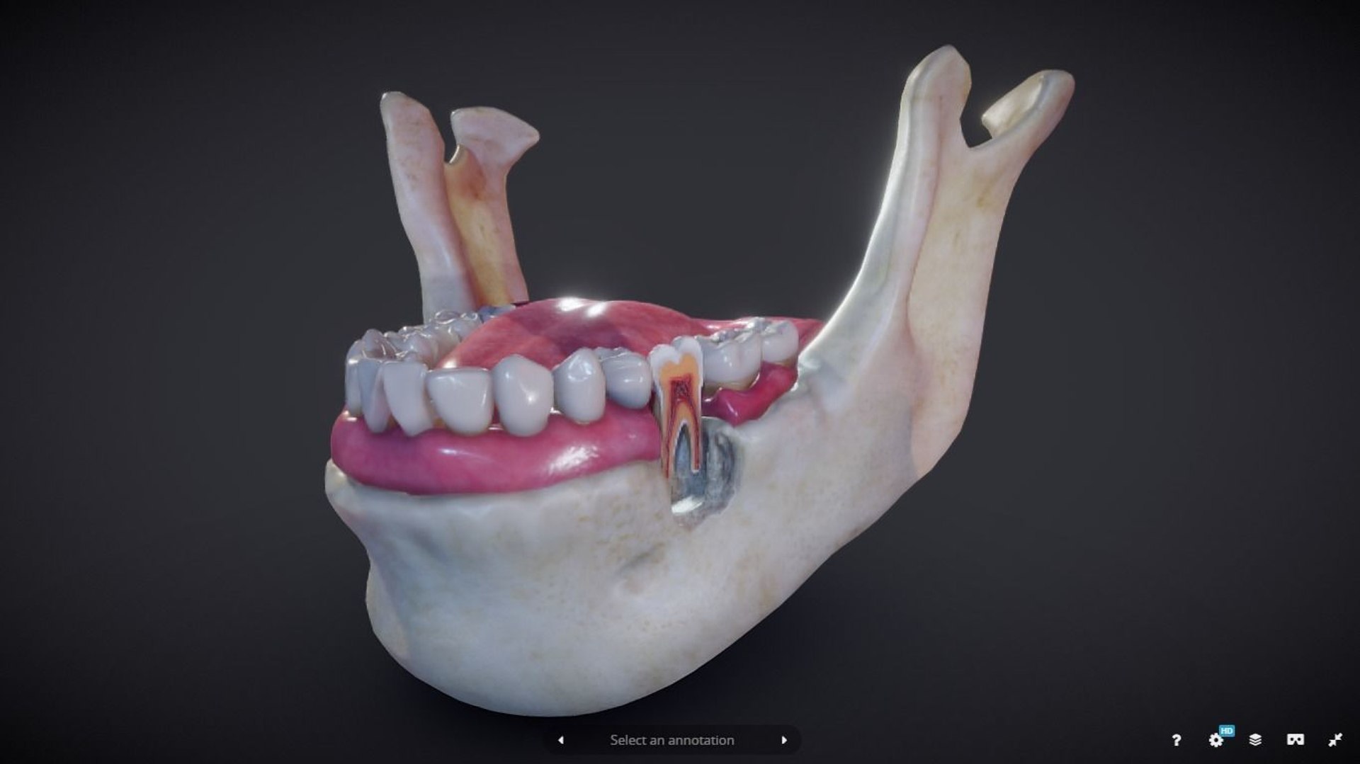 Tooth Mandible Model - TurboSquid 1618843