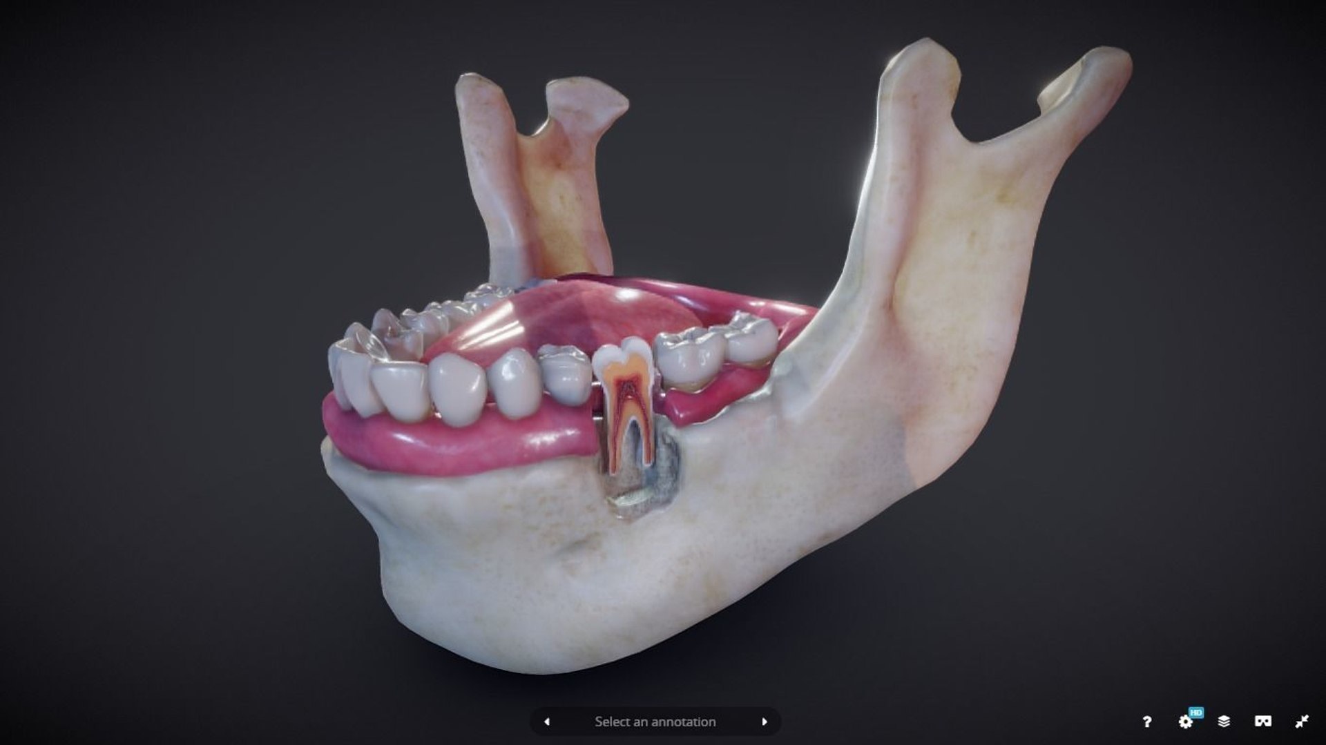 Tooth Mandible Model - TurboSquid 1618843