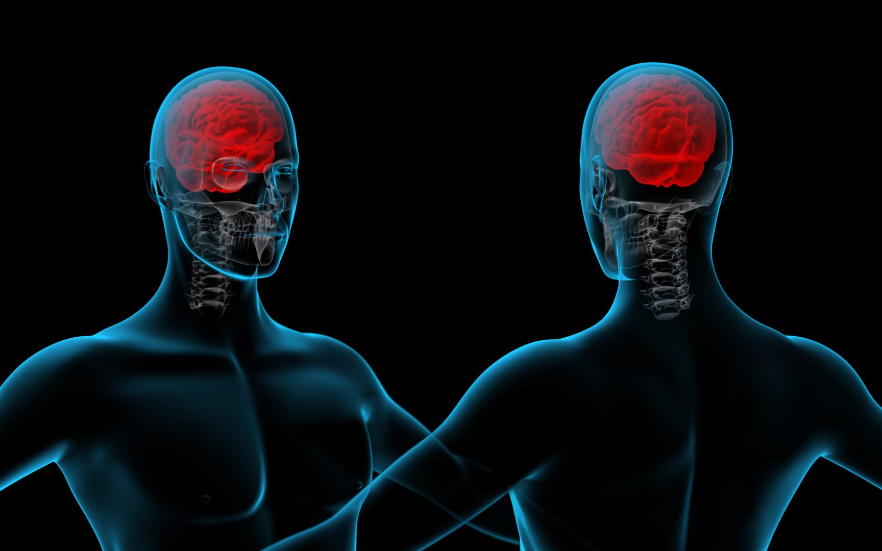 Brain X-Ray 3D Model - TurboSquid 1986061