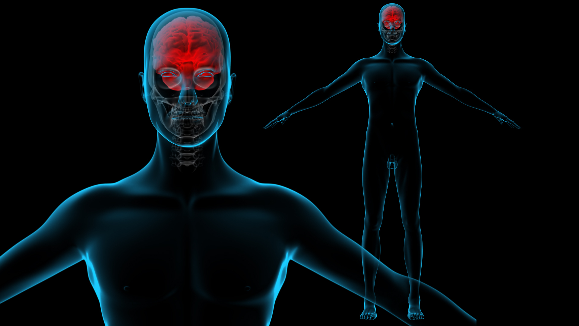 Brain X-Ray 3D Model - TurboSquid 1986061