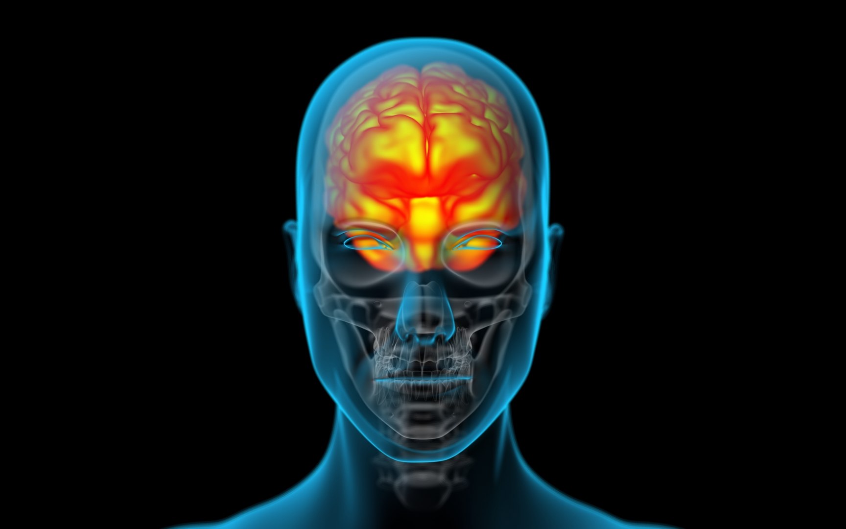 Brain X-Ray 3D Model - TurboSquid 1986061