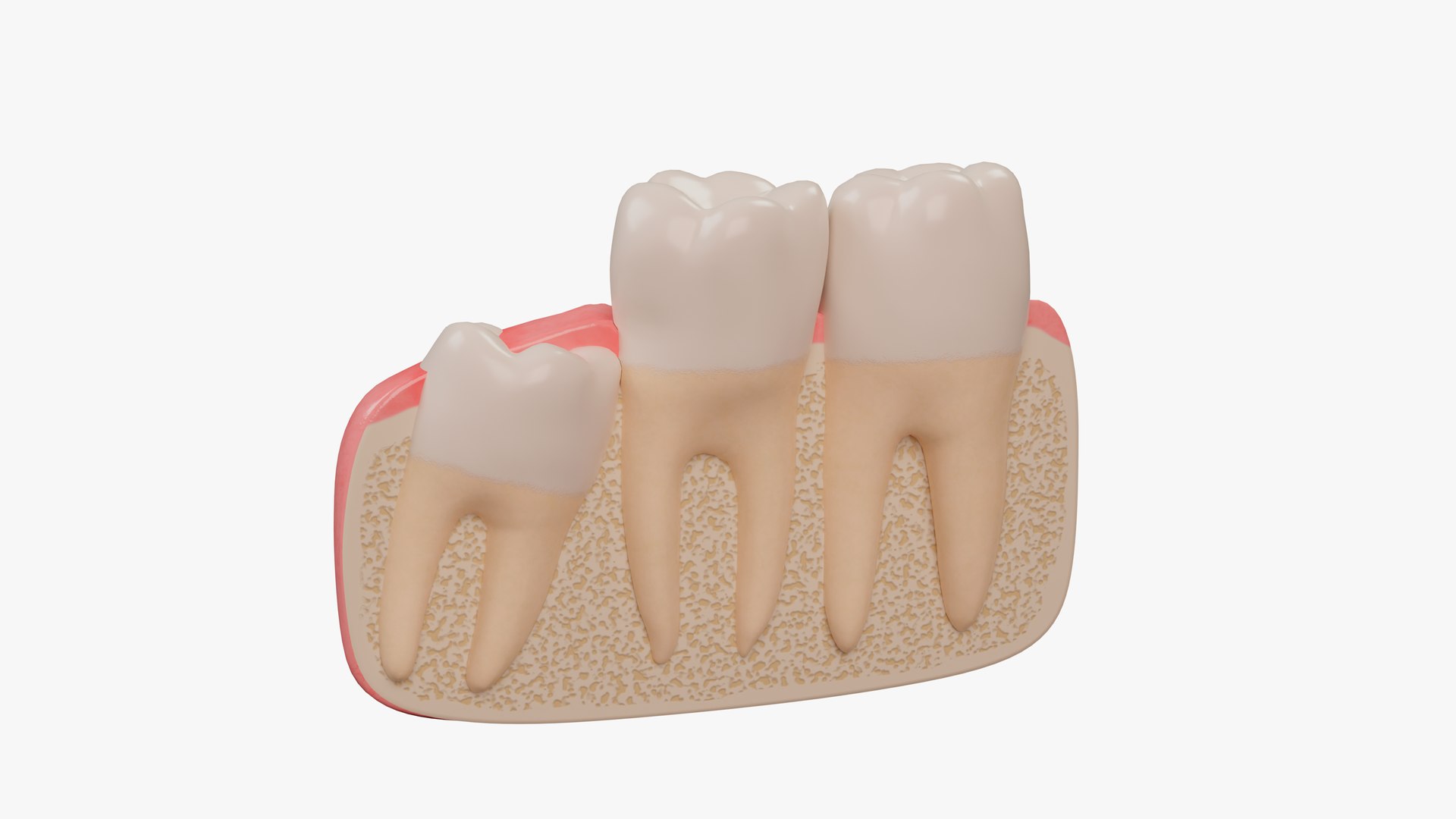 Impacted Wisdom Teeth Incision Model - TurboSquid 1866827