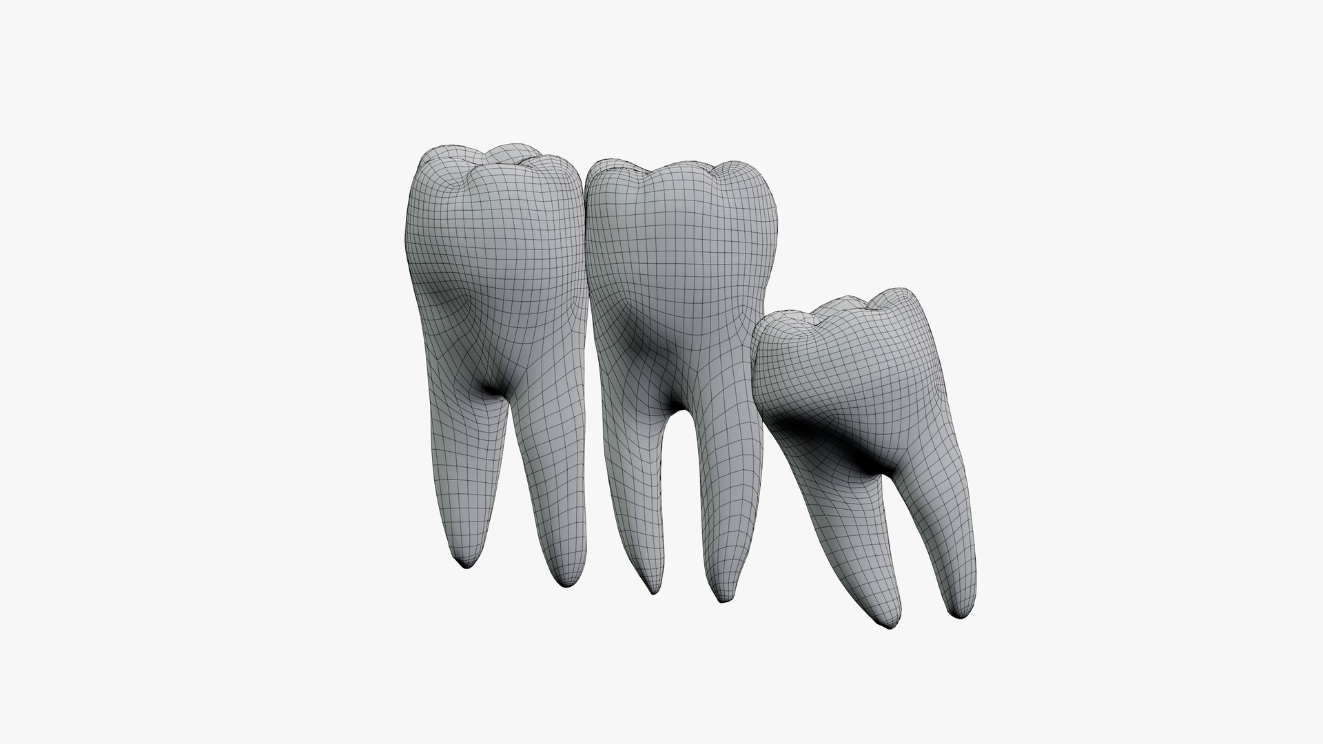 Impacted Wisdom Teeth Incision Model - TurboSquid 1866827