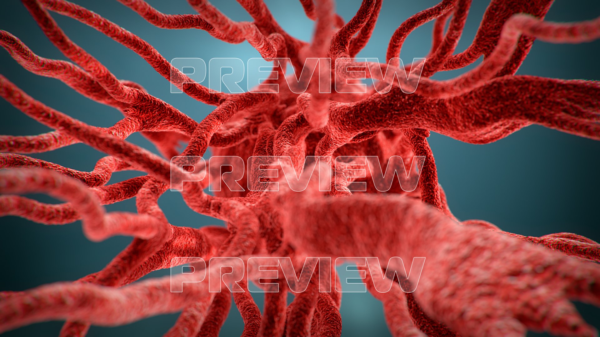 Cancer Growth Static Sequence 3D Model - TurboSquid 1209123
