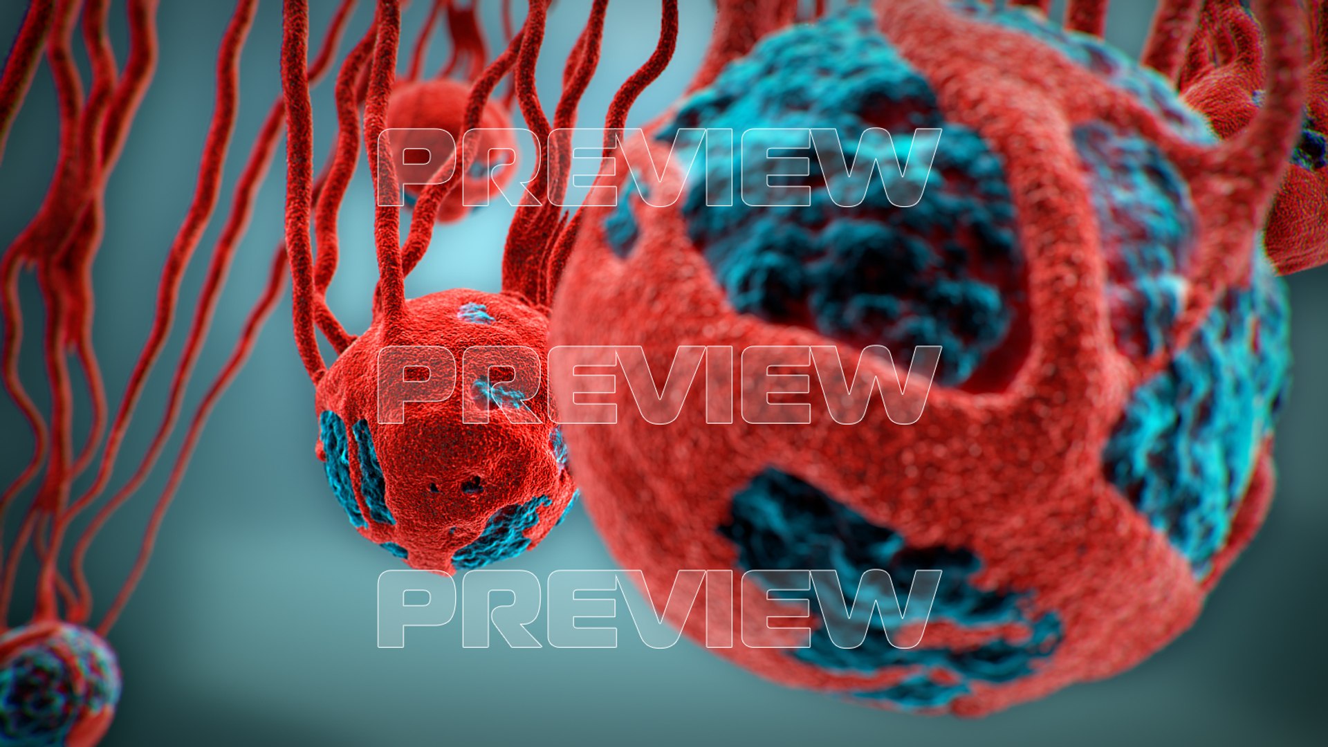 Cancer Growth Static Sequence 3D Model - TurboSquid 1209123