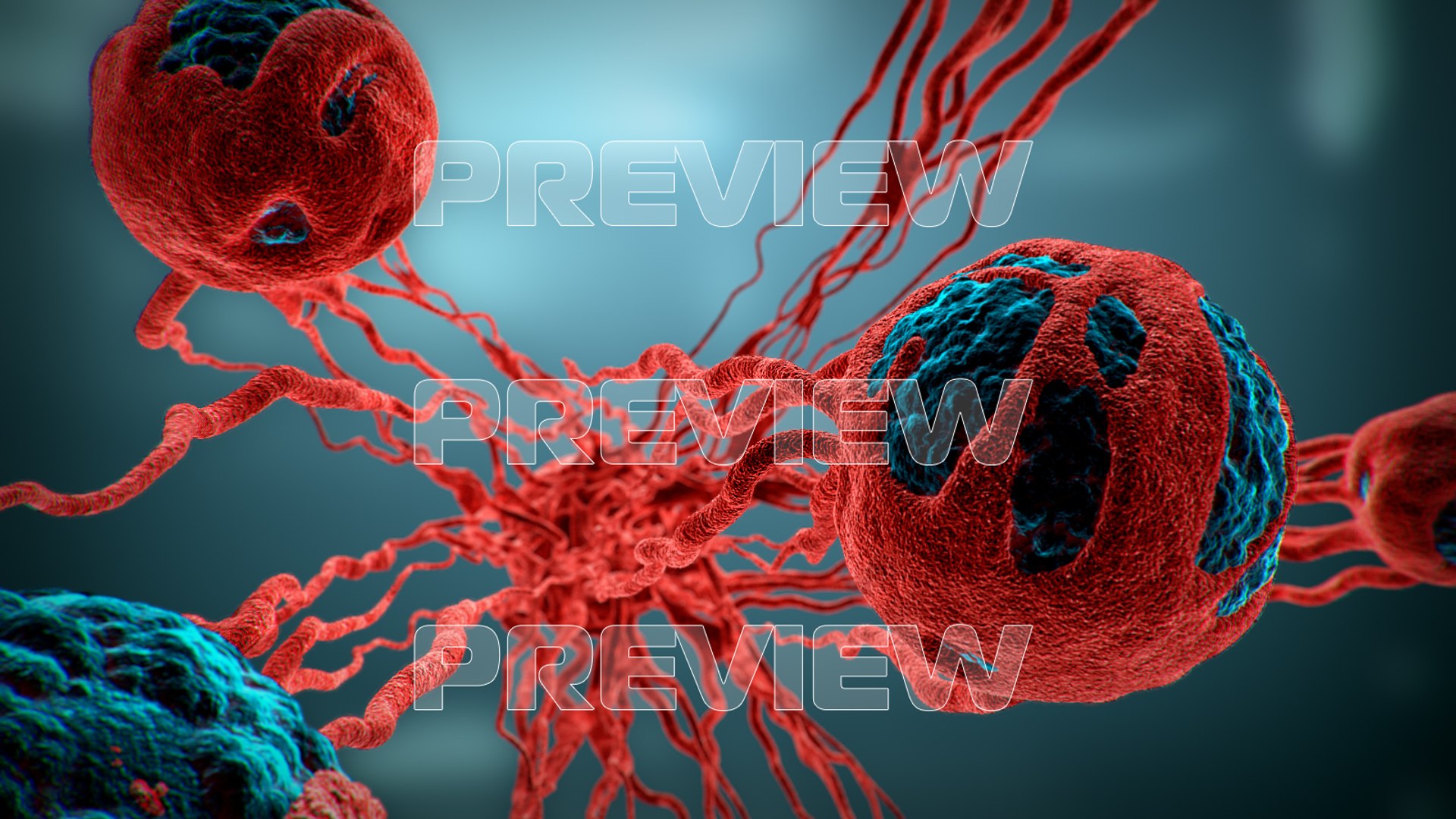 Cancer Growth Static Sequence 3D Model - TurboSquid 1209123