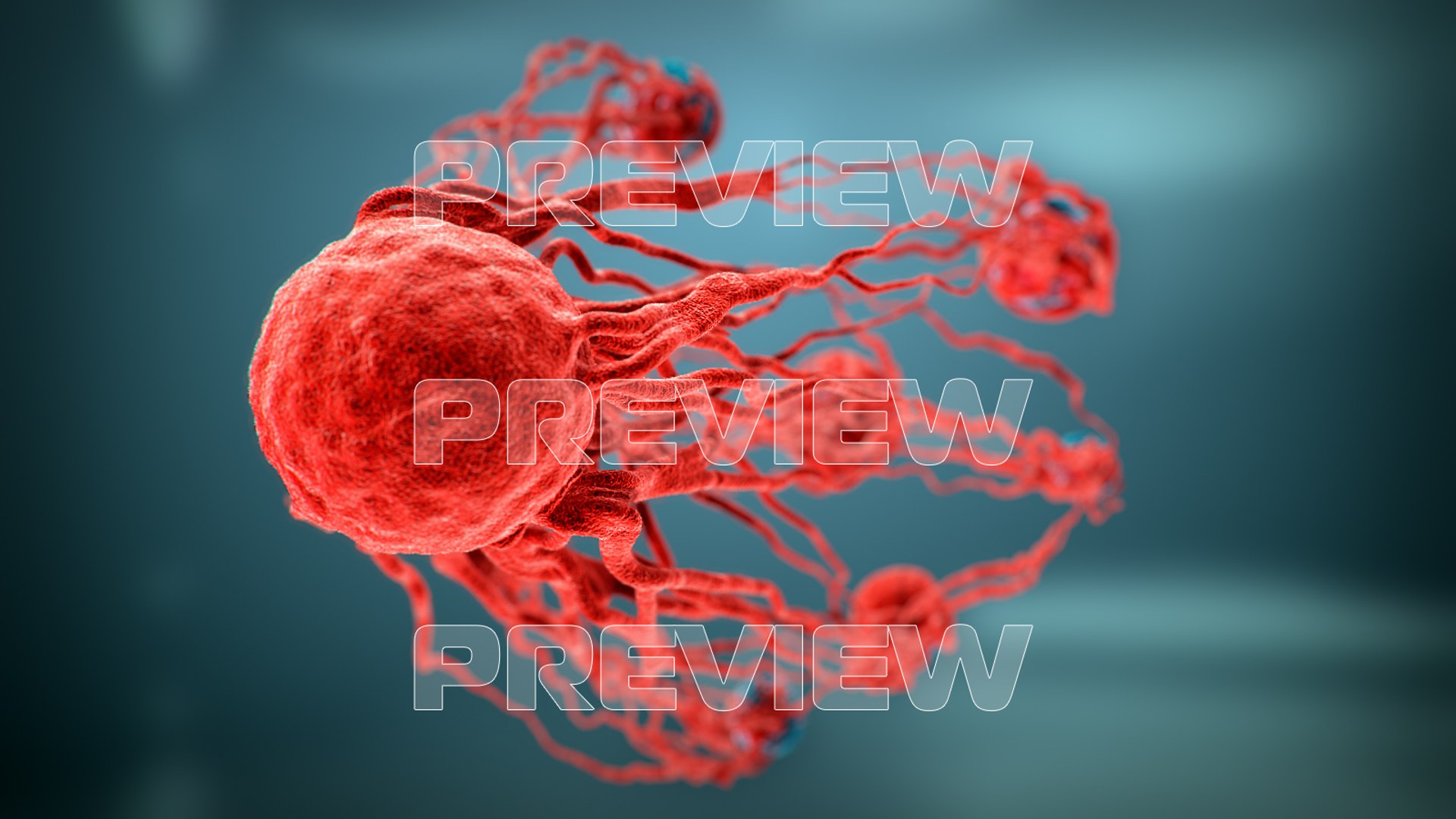 Cancer Growth Static Sequence 3D Model - TurboSquid 1209123