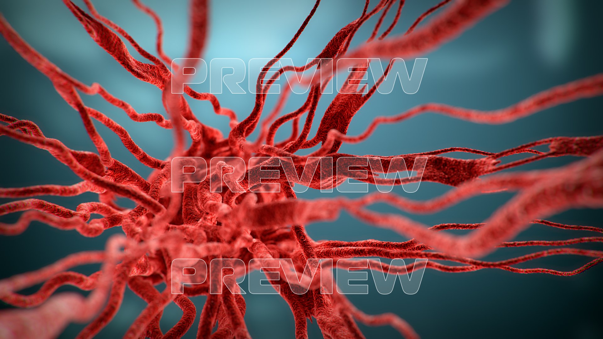 Cancer Growth Static Sequence 3D Model - TurboSquid 1209123