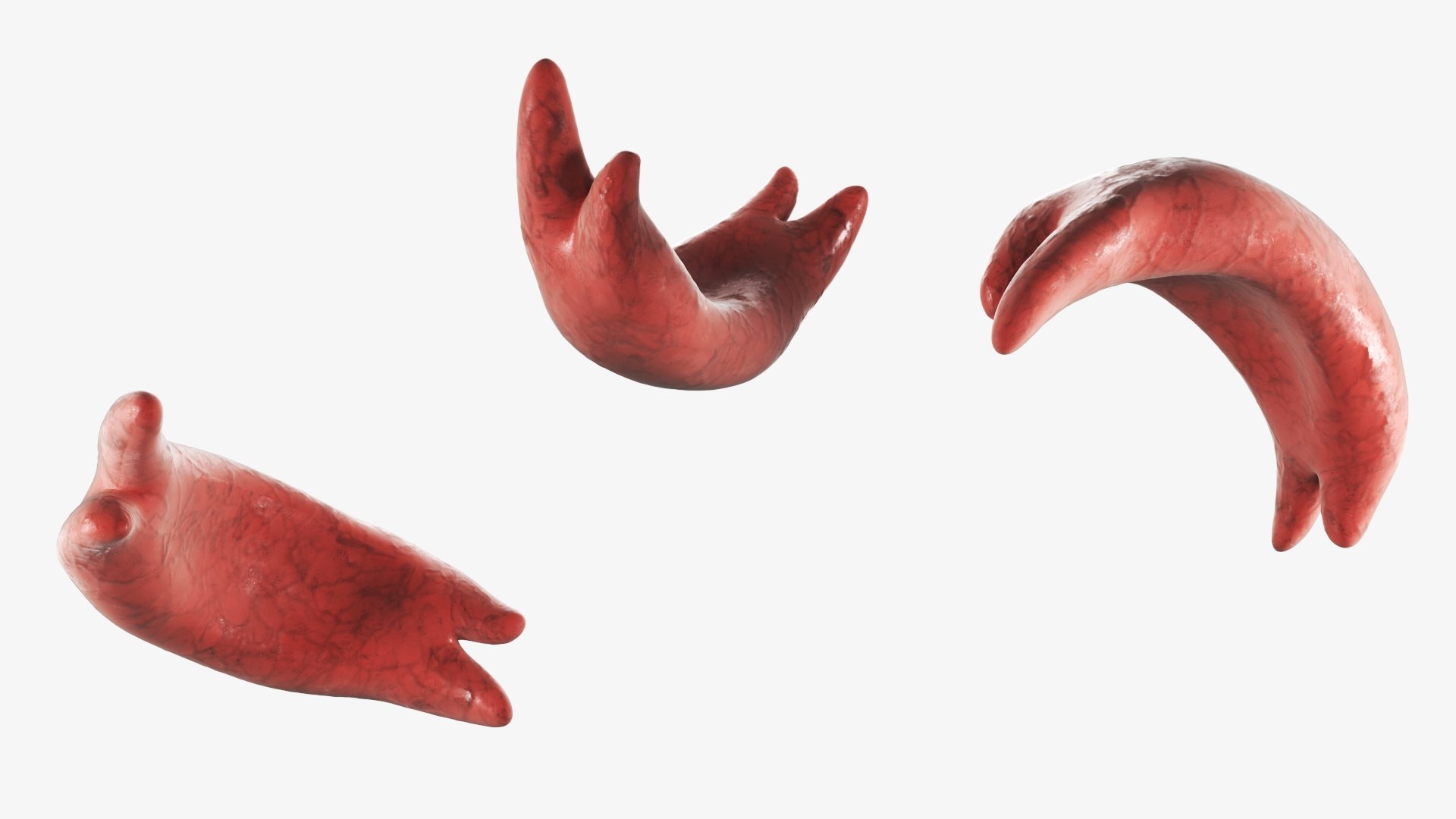 Sickle Cell Disease 3D Model - TurboSquid 1963320