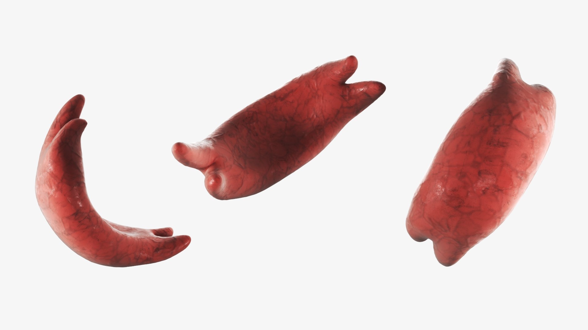 Sickle Cell Disease 3D Model - TurboSquid 1963320
