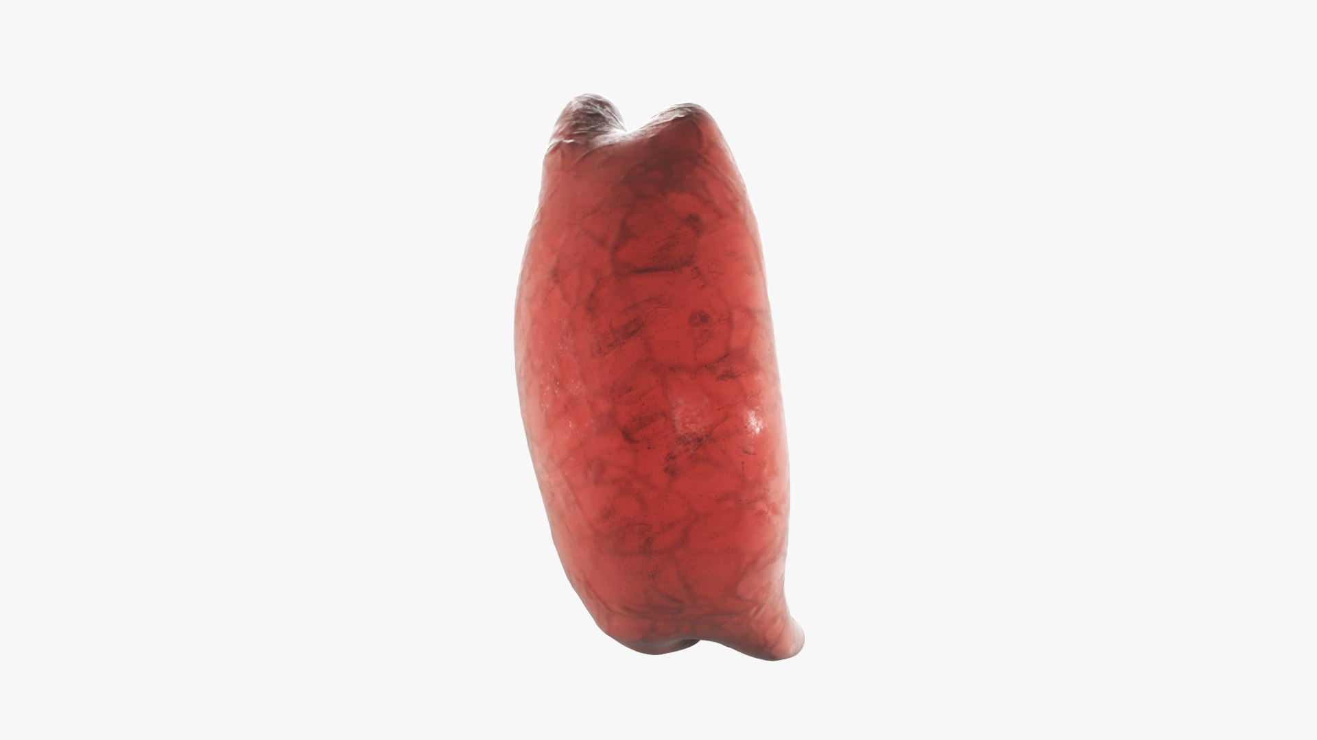 Sickle Cell Disease 3D Model - TurboSquid 1963320