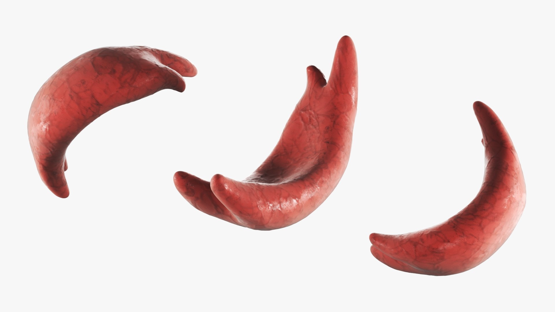 Sickle Cell Disease 3D Model - TurboSquid 1963320