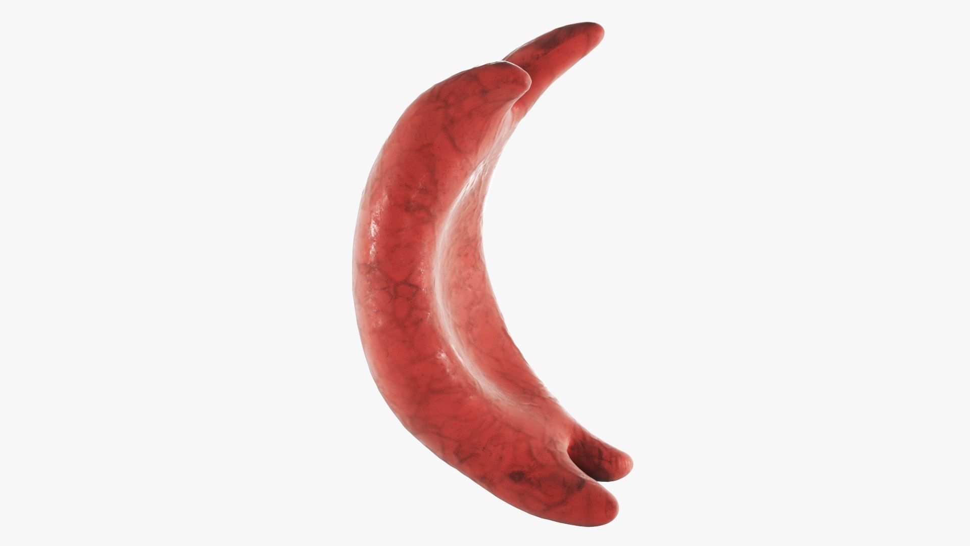 Sickle Cell Disease 3D Model - TurboSquid 1963320